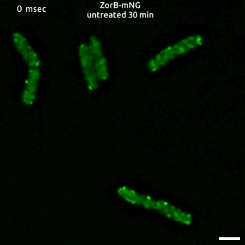 Structure and mechanism of the Zorya anti-phage defense system ...