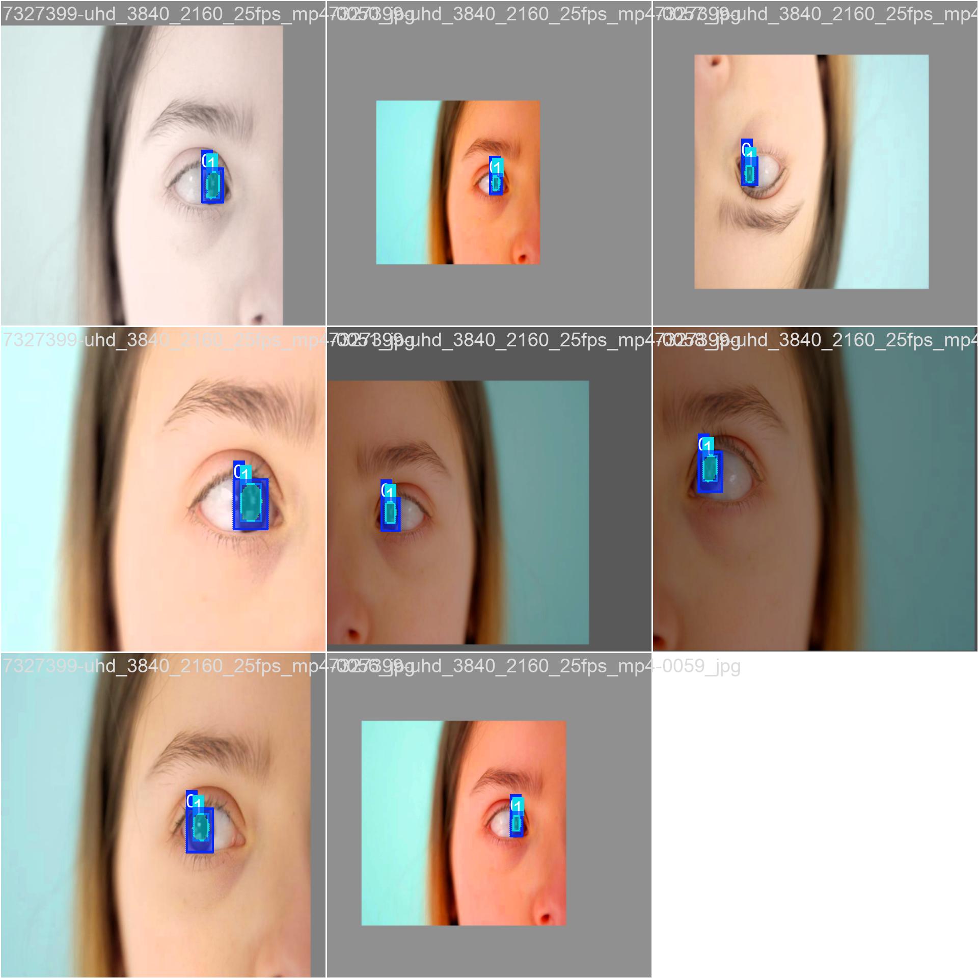 Advancing Eye Analysis and Eye-Tracking with Ultralytics YOLO11 and EMME: Applications in ...