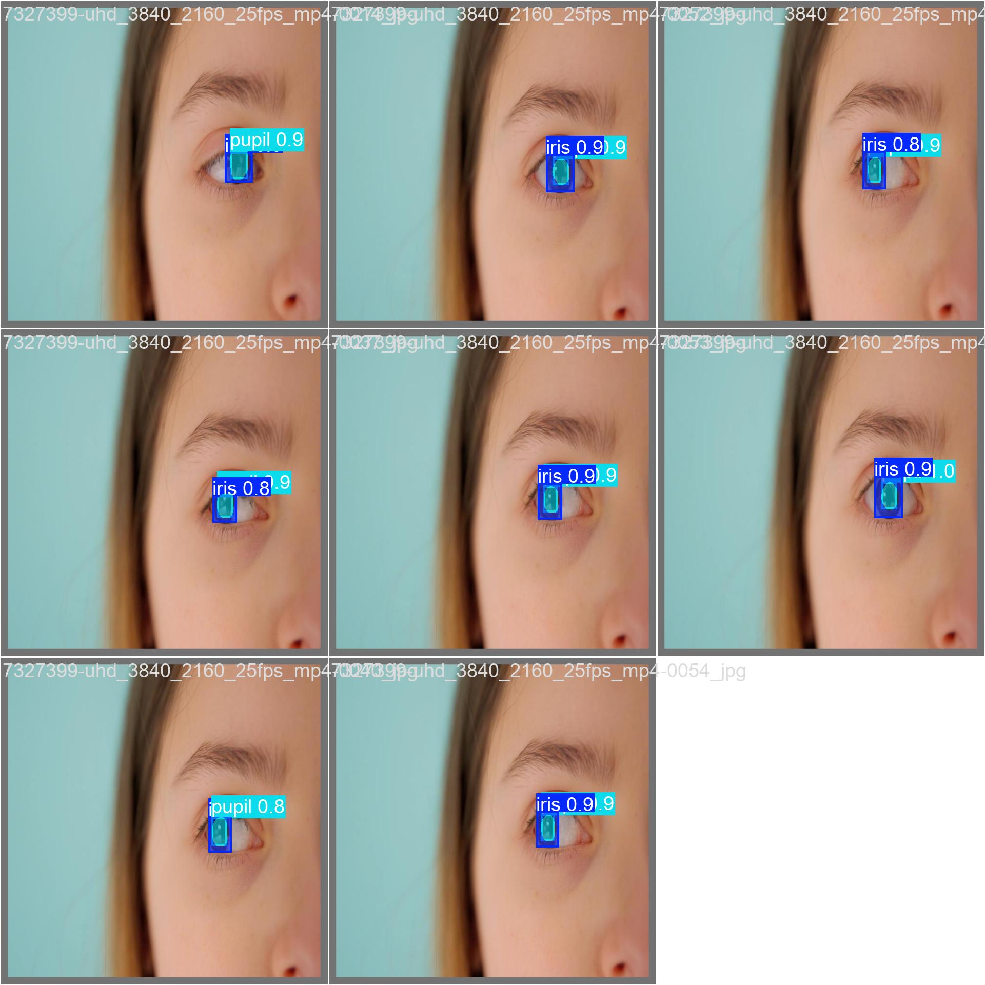 Advancing Eye Analysis and Eye-Tracking with Ultralytics YOLO11 and EMME: Applications in ...