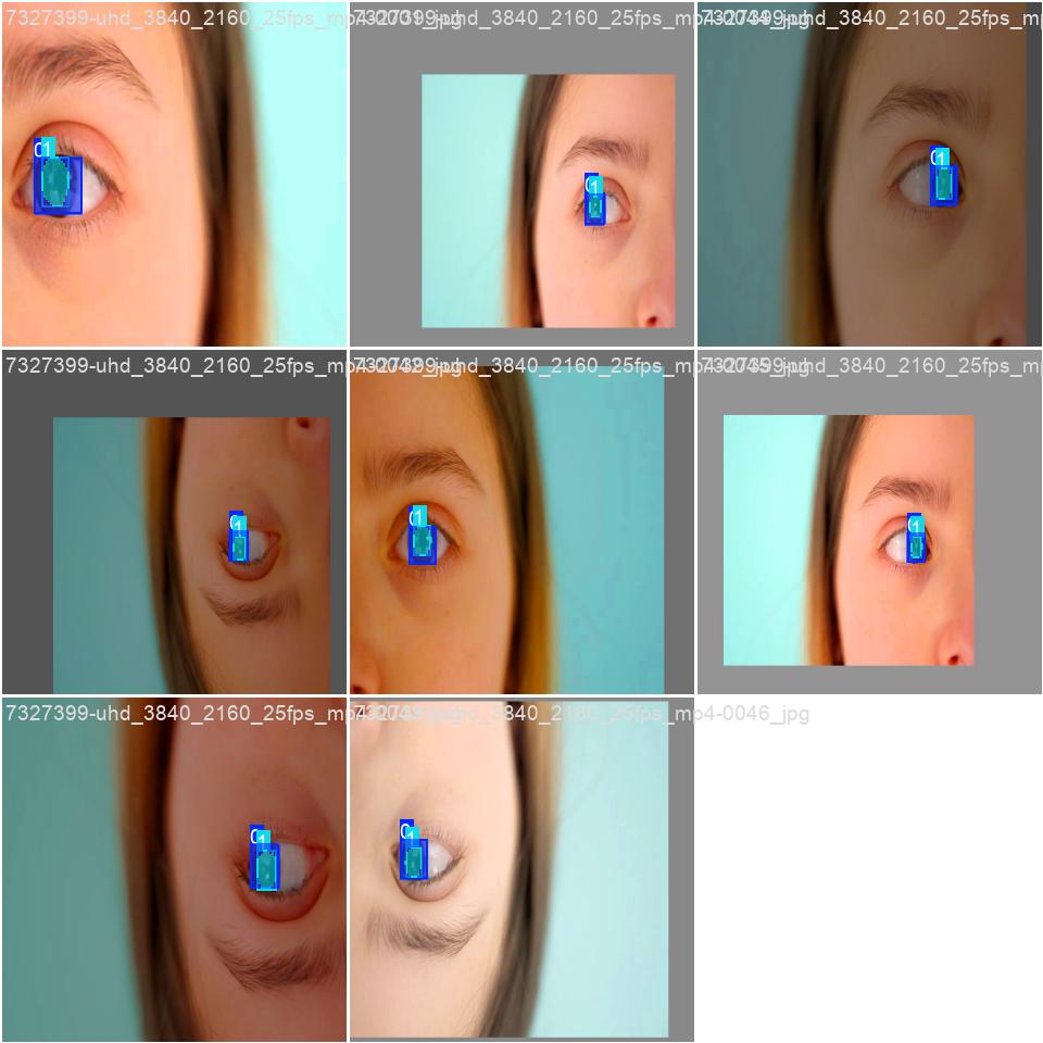 Advancing Eye Analysis and Eye-Tracking with Ultralytics YOLO11 and EMME: Applications in ...