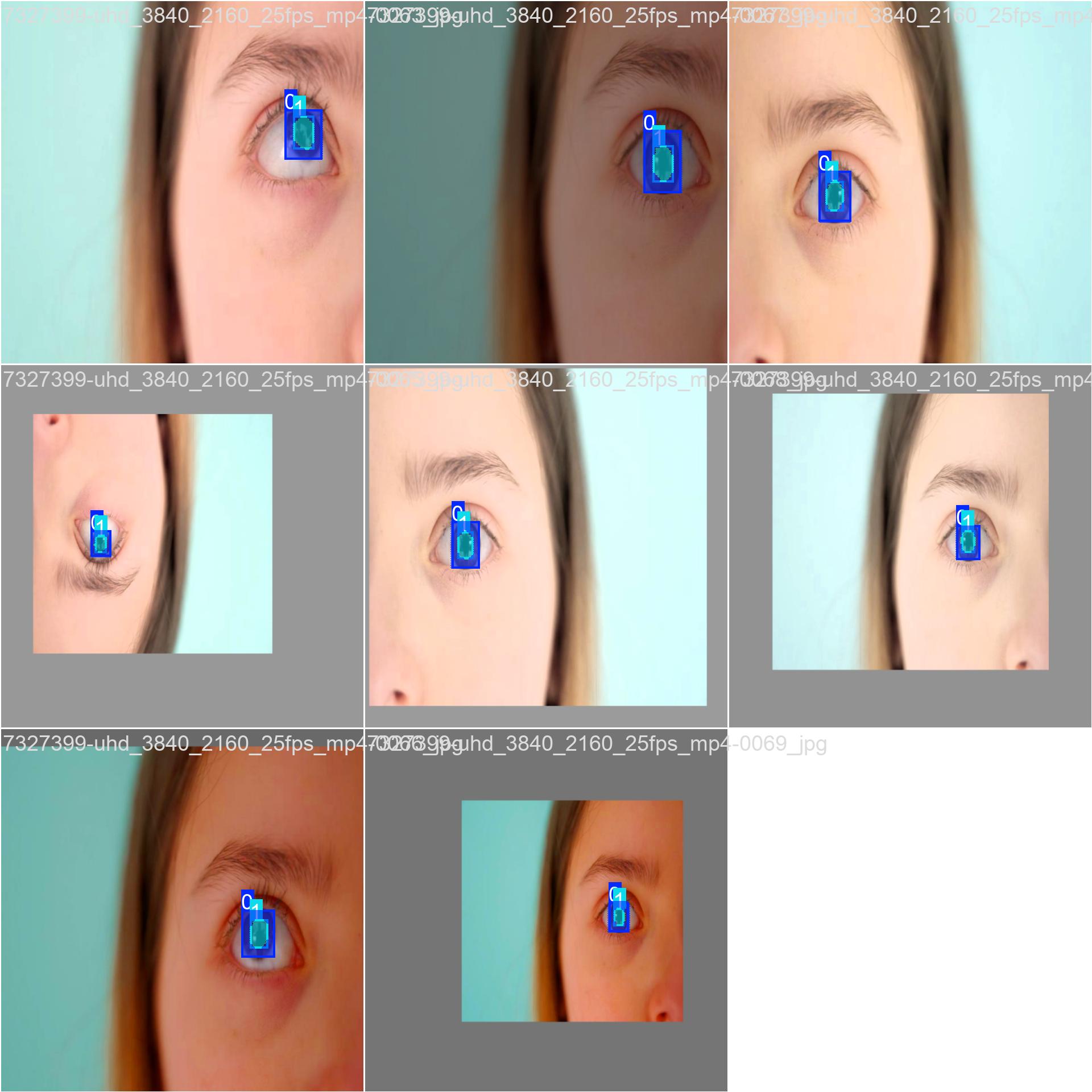 Advancing Eye Analysis and Eye-Tracking with Ultralytics YOLO11 and EMME: Applications in ...