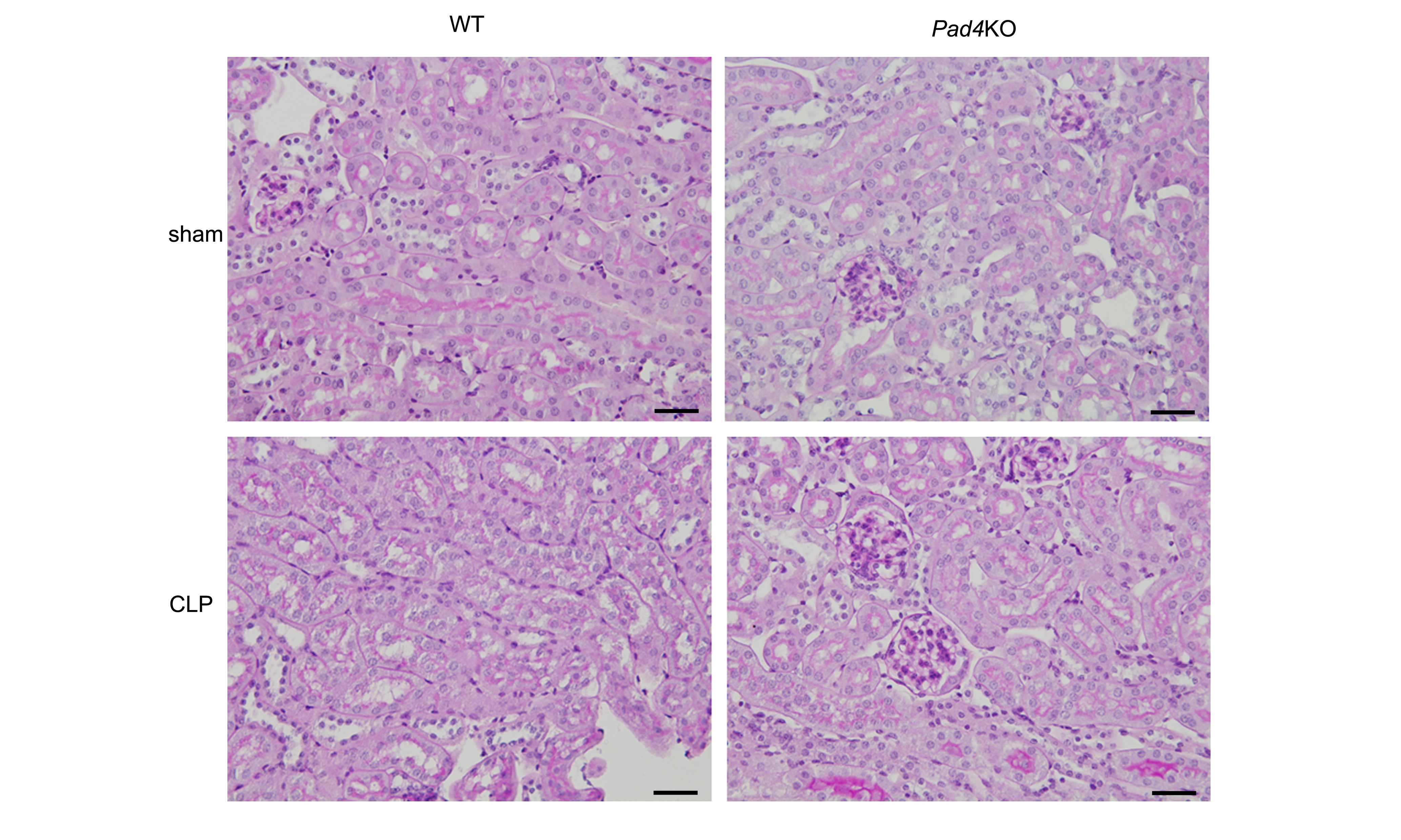 Peritoneal Neutrophil Extracellular Traps contribute to septic AKI via ...