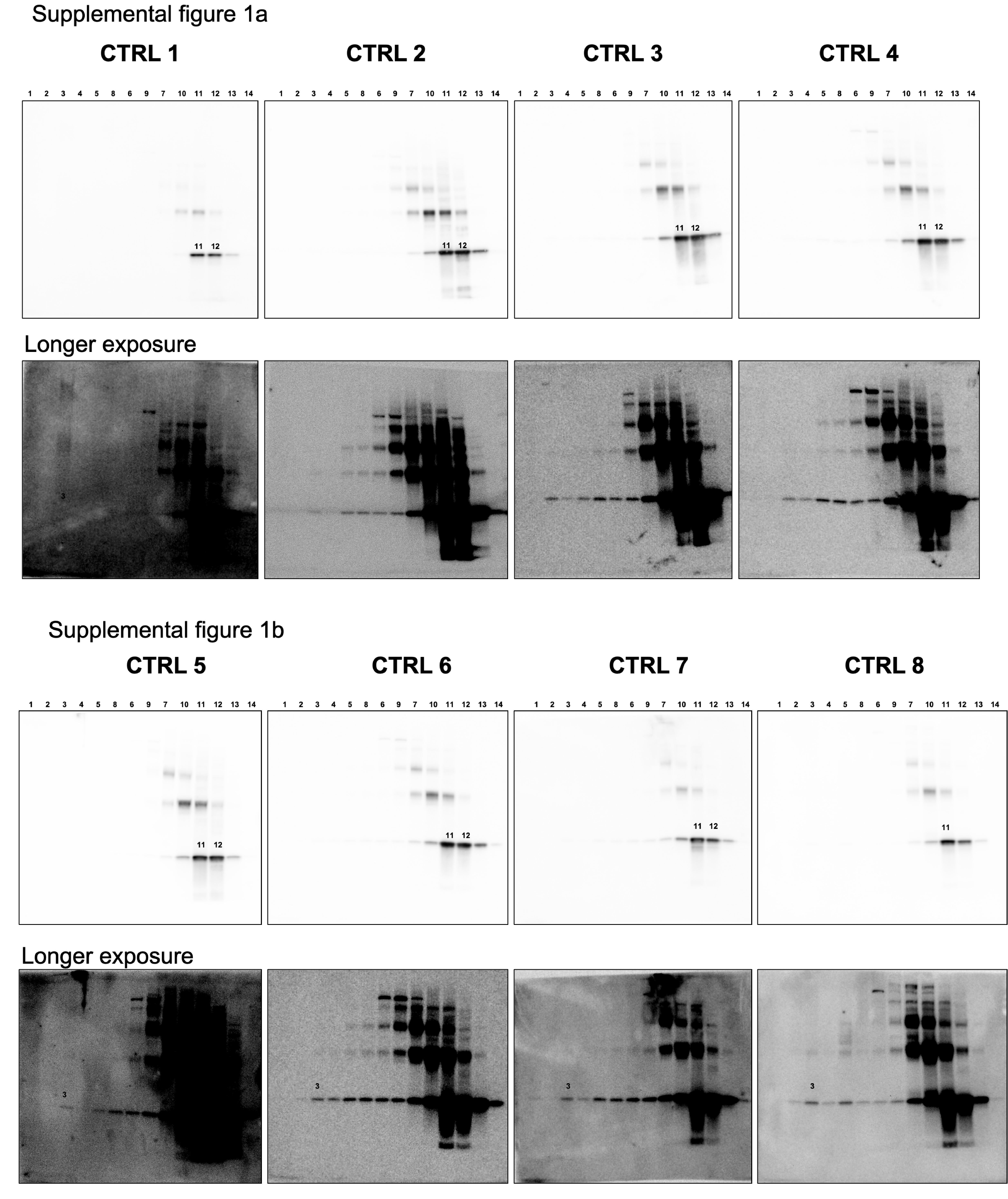 Higher molecular weight alpha-synuclein oligomers are increased in ...