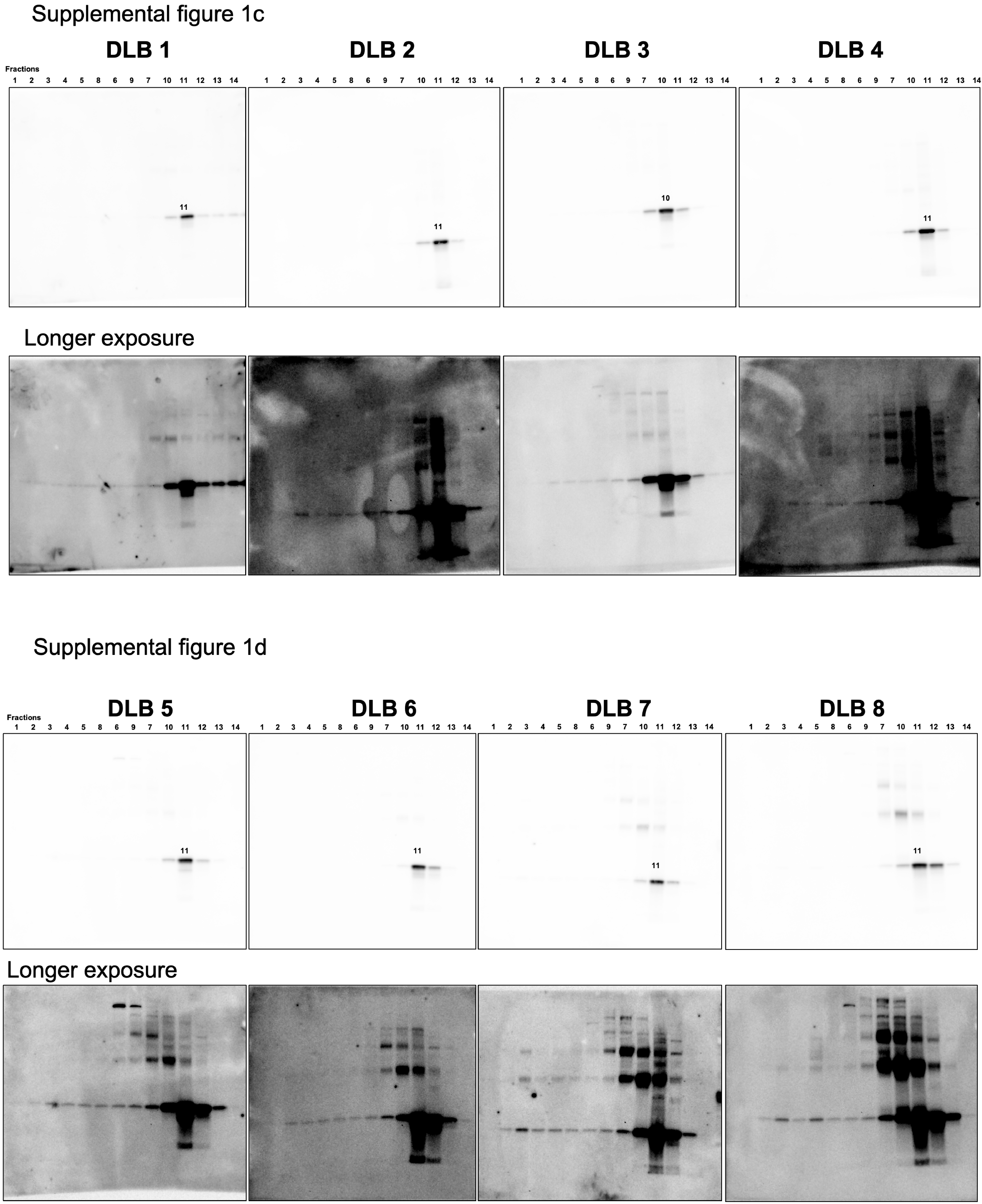 Higher molecular weight alpha-synuclein oligomers are increased in ...